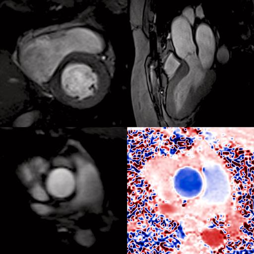 MAGNETOM 7T - Cardio - Functional and flow imaging