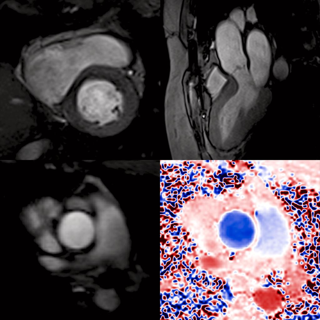 MAGNETOM 7T - Cardio - Functional and flow imaging