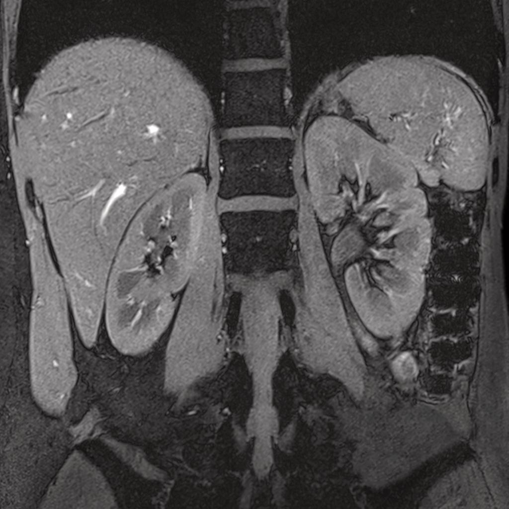 MAGNETOM 7T - Abdomen