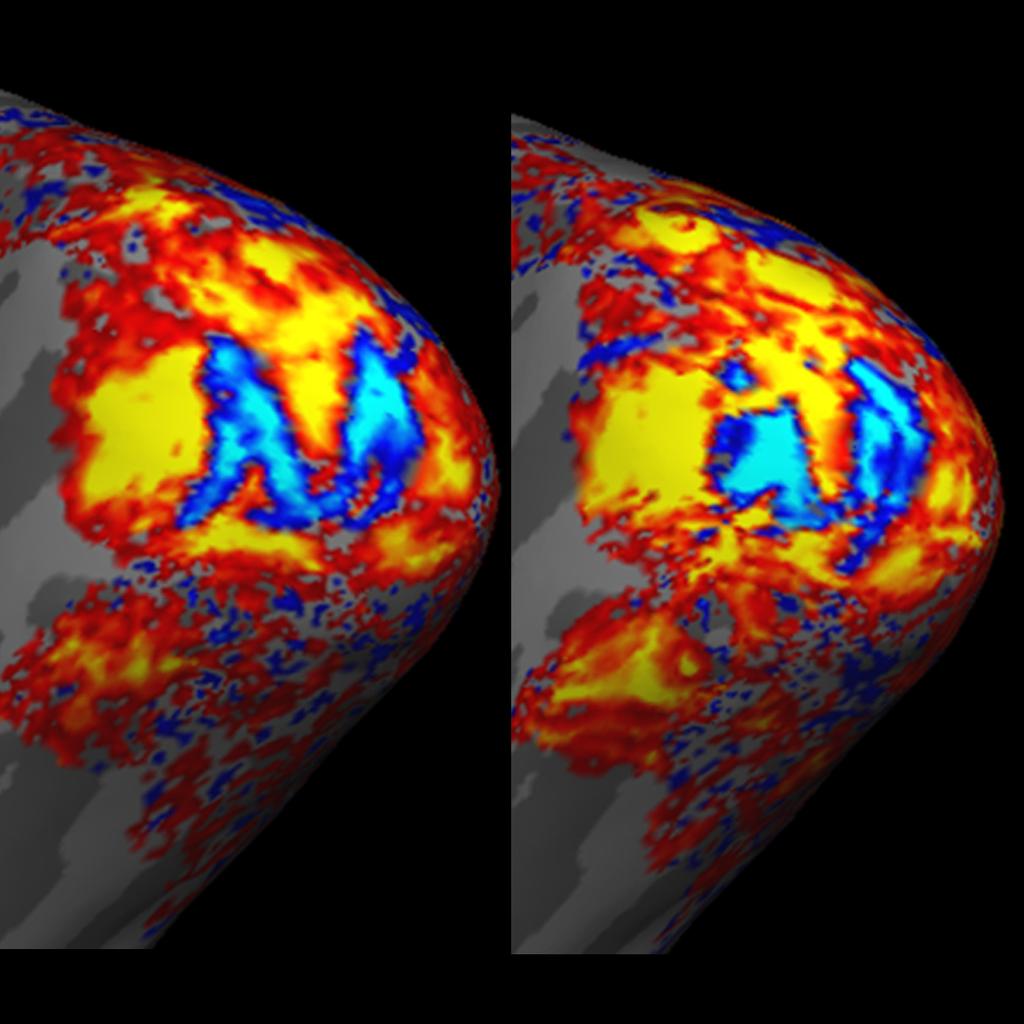 MAGNETOM 7T - Head - Functional MRI at 7T