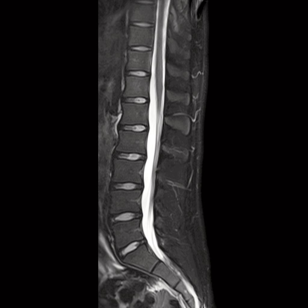 Magnetic Resonance Imaging – Clinical Images