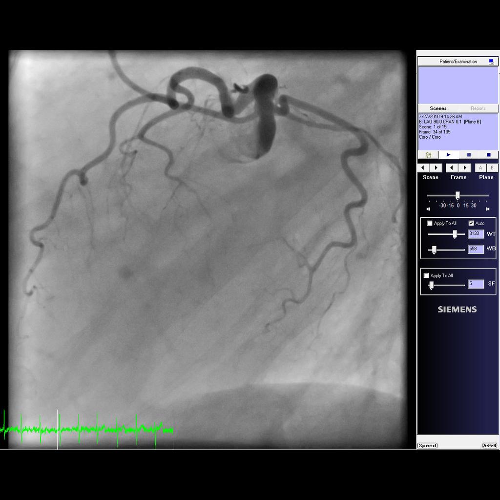 ACOM.PC - Siemens Healthineers USA