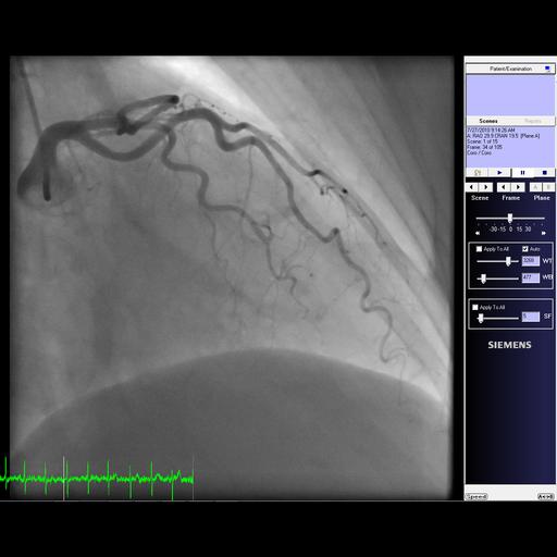 Options & Upgrades - Get the most from your investment - Siemens ...