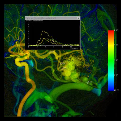syngo iFlow - Siemens Healthineers
