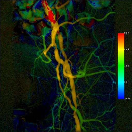 syngo iFlow - Siemens Healthineers