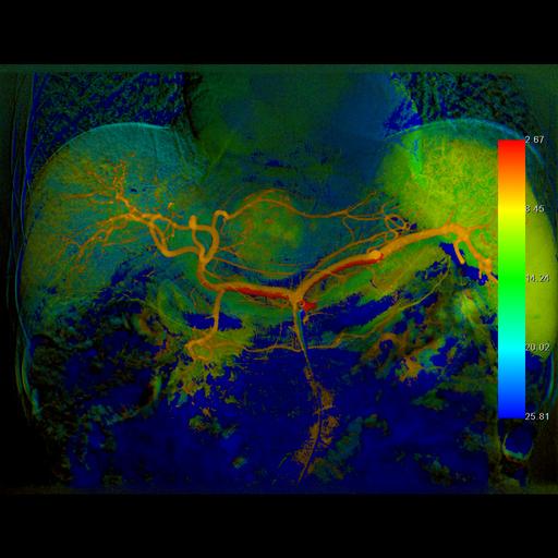 syngo iFlow - Siemens Healthineers