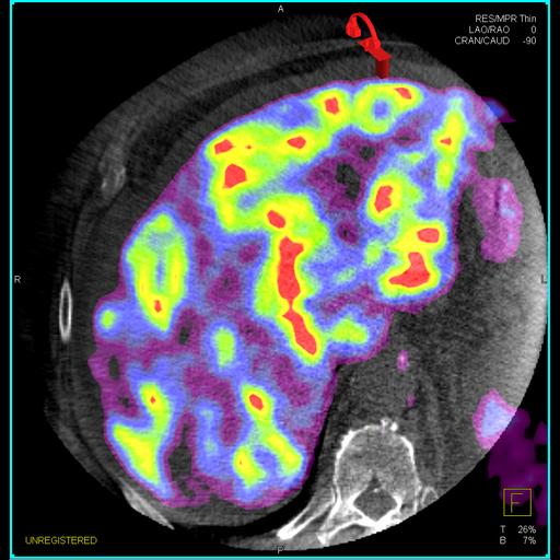 Options & Upgrades - Get the most from your investment - Siemens ...