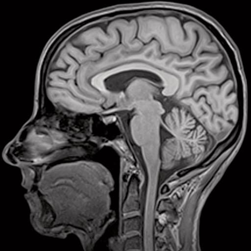 MAGNETOM Trio, A Tim System - Head