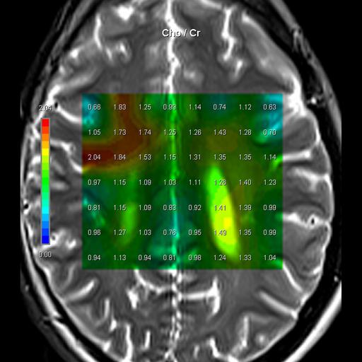 MAGNETOM Verio - Head