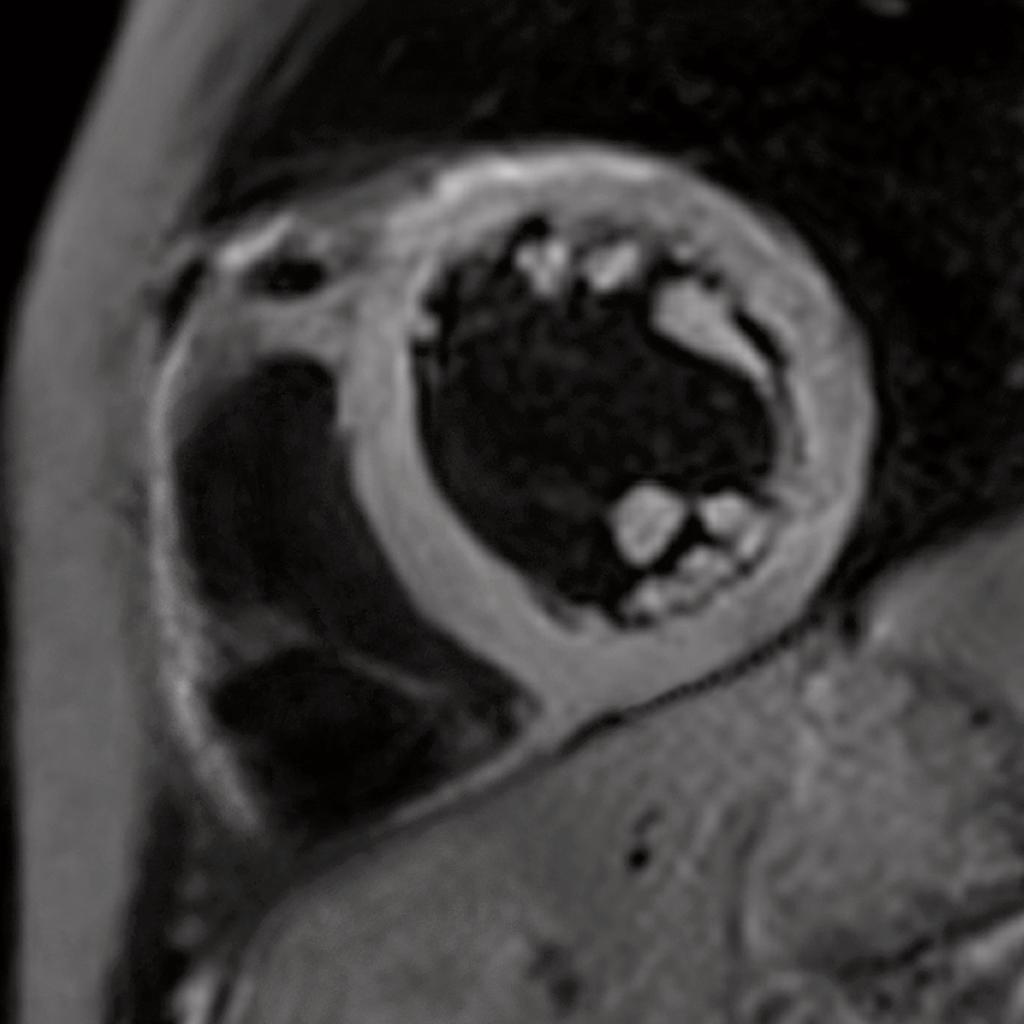 MAGNETOM Verio - Cardio