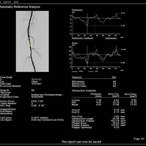 Options & Upgrades - Get the most from your investment - Siemens ...
