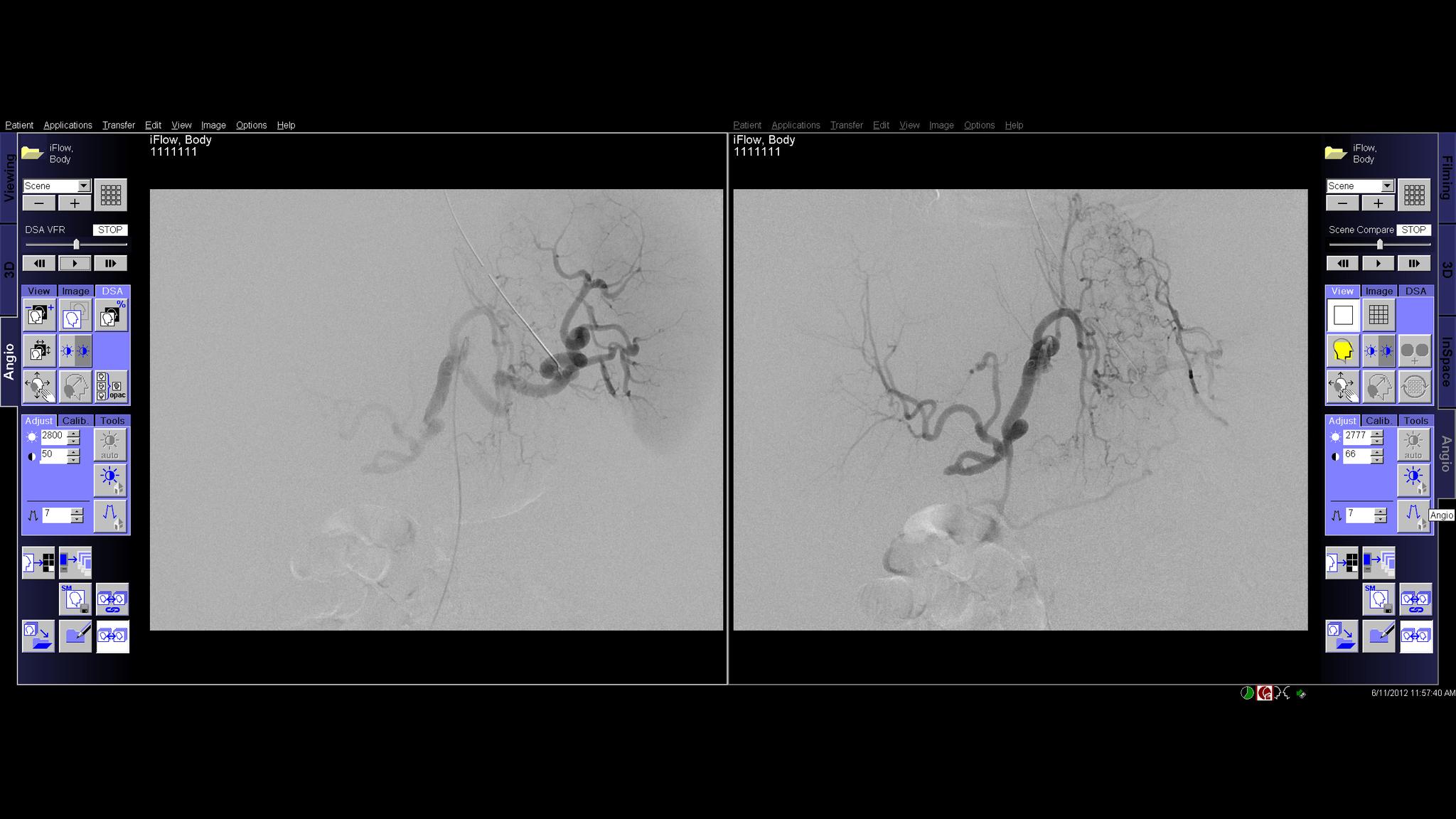 syngo Scene Compare Siemens Healthineers Italia