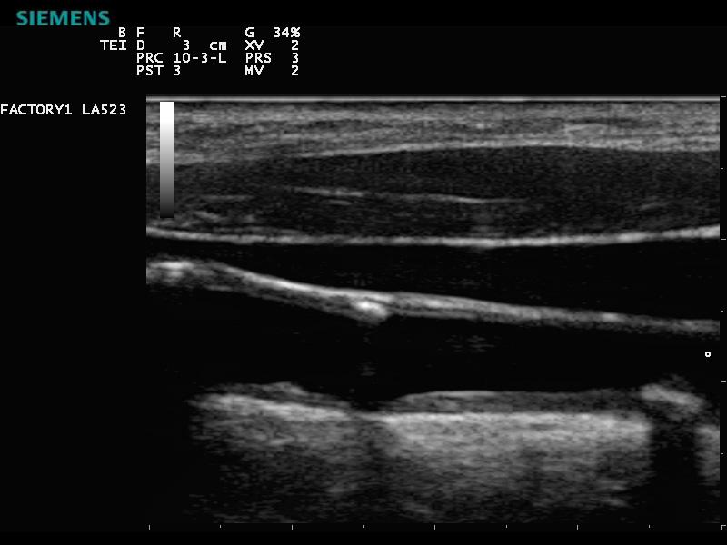 Clinical images and videos - Siemens Healthineers Polska