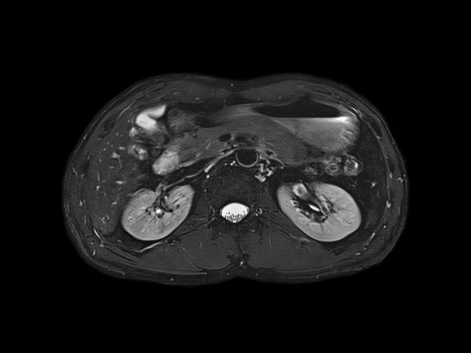 MAGNETOM Spectra - Siemens Healthineers Italia
