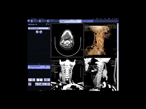 syngo.via for Interventional Imaging - Siemens Healthineers USA