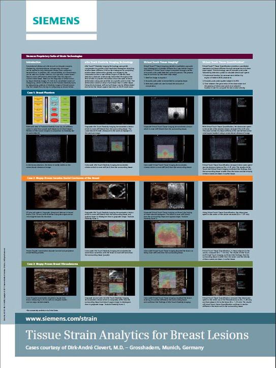 Poster: Tissue Strain Analytics for Breast Lesions - Siemens ...