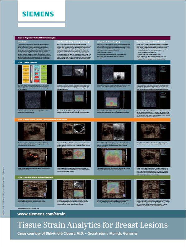 Poster: Tissue Strain Analytics for Breast Lesions - Siemens ...