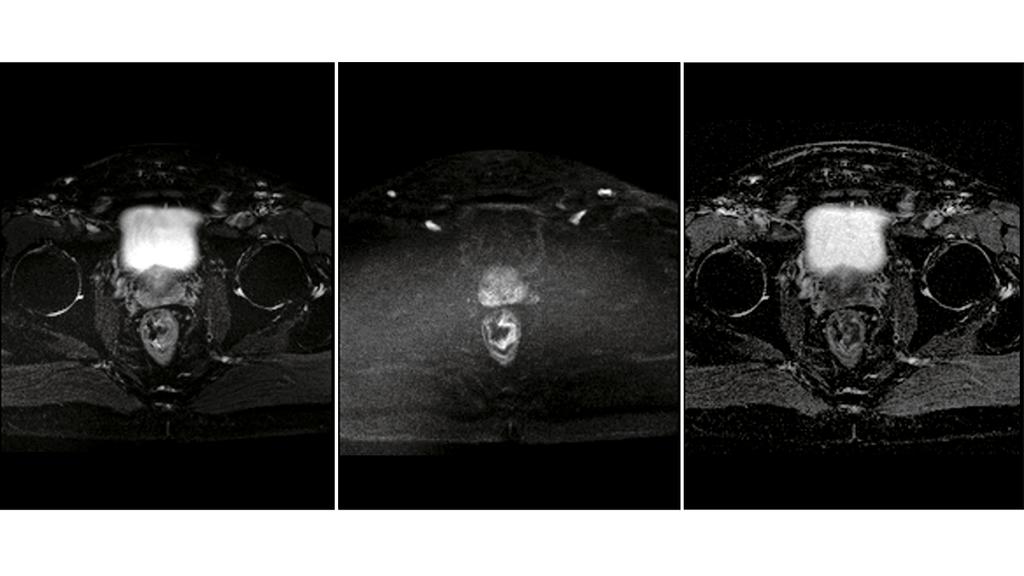 syngo RESOLVE - Siemens Healthineers USA