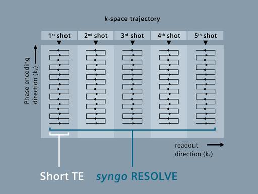 syngo RESOLVE - Siemens Healthineers USA