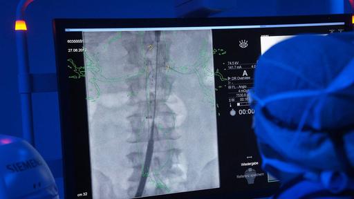 EVAR-3D Guidance - Siemens Healthineers Canada