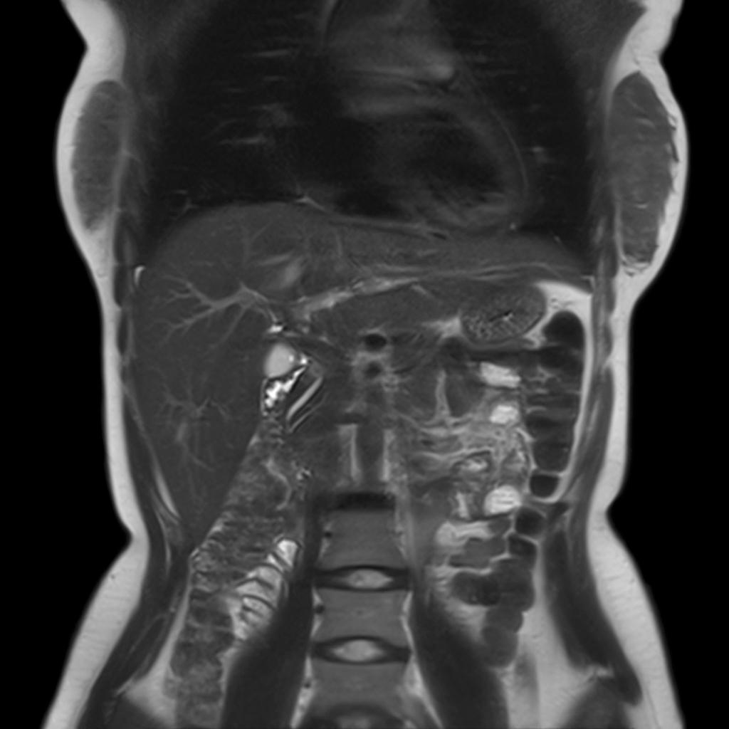 MAGNETOM Trio Upgrade - Siemens Healthineers Italia