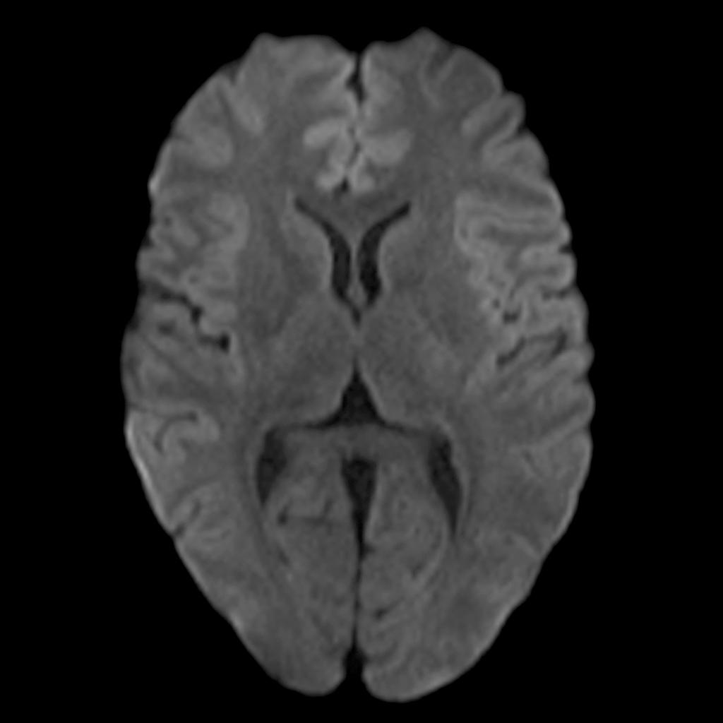 MAGNETOM Trio Upgrade - Siemens Healthineers Italia