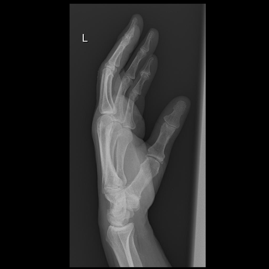 Mira wiD, Hand, oblique - Siemens Healthineers Česká republika