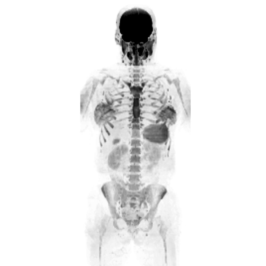 MAGNETOM Avanto Upgrade Siemens Healthineers Italia