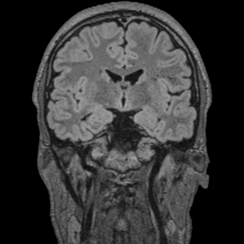 MAGNETOM Avanto Upgrade Siemens Healthineers Italia