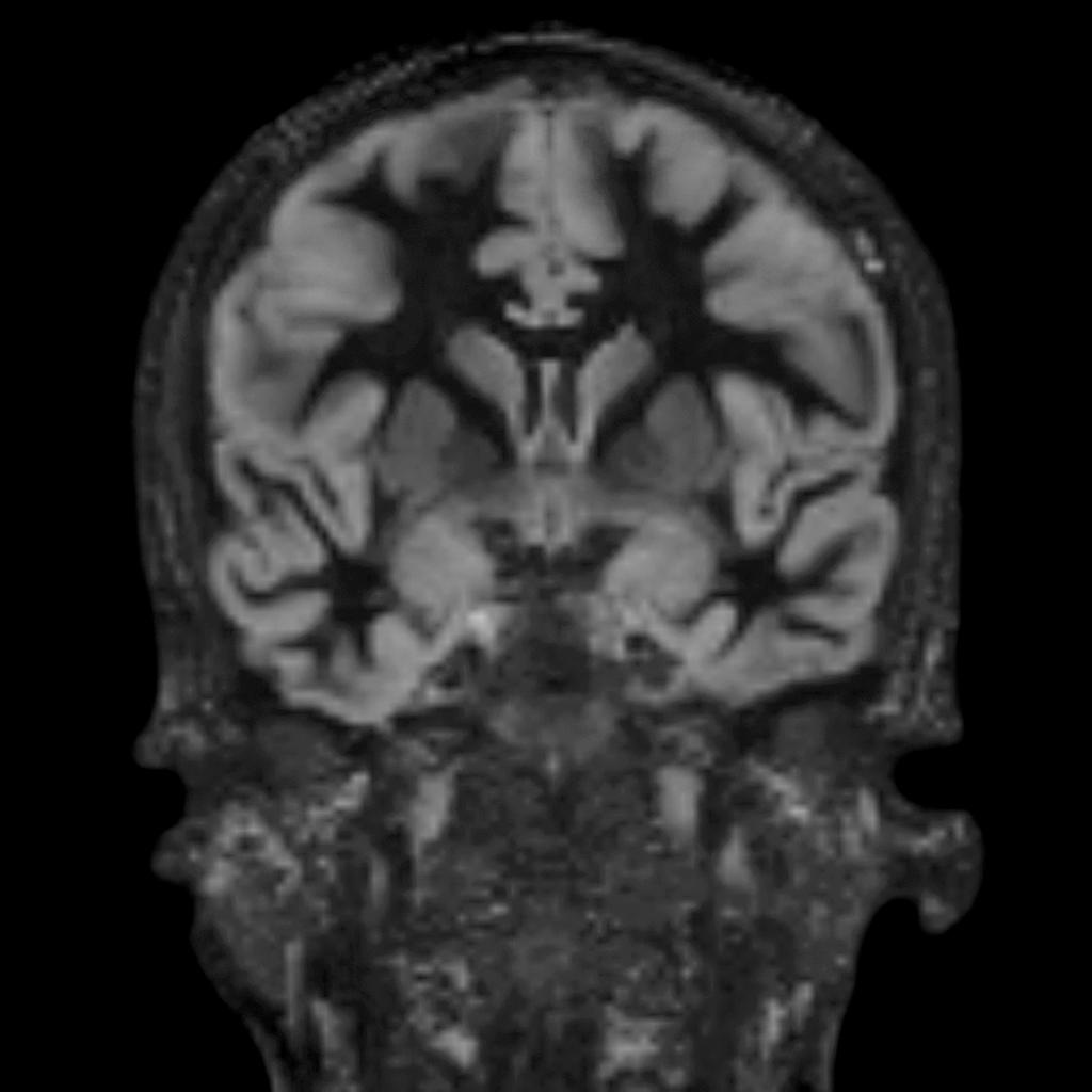 MAGNETOM Avanto Upgrade Siemens Healthineers Italia