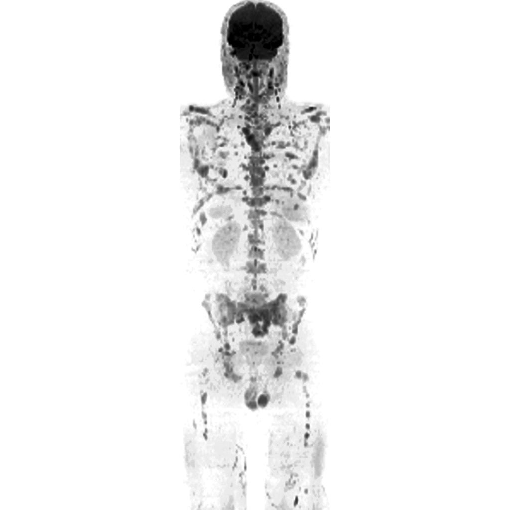 MAGNETOM Avanto Upgrade Siemens Healthineers Italia