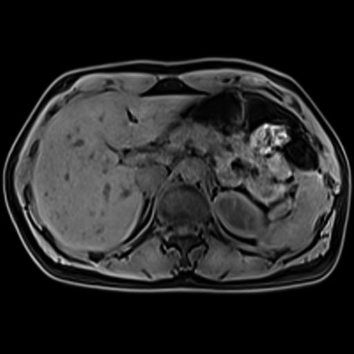 MAGNETOM Verio Upgrade Siemens Healthineers Italia