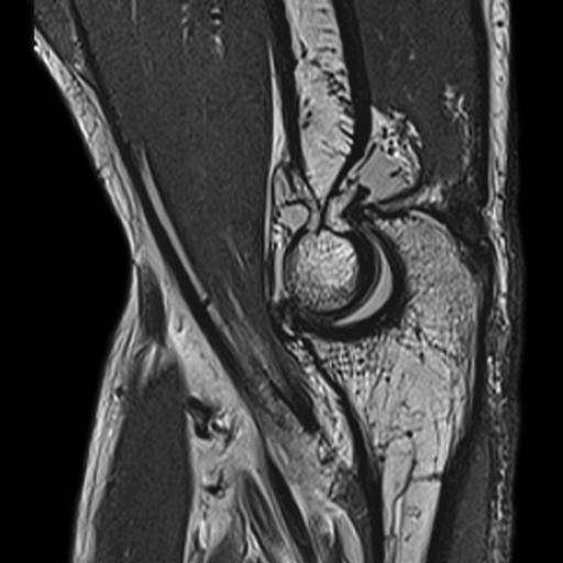 MAGNETOM Verio Upgrade Siemens Healthineers Italia