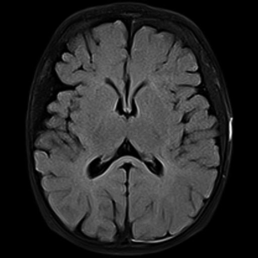 MAGNETOM Verio Upgrade Siemens Healthineers Italia