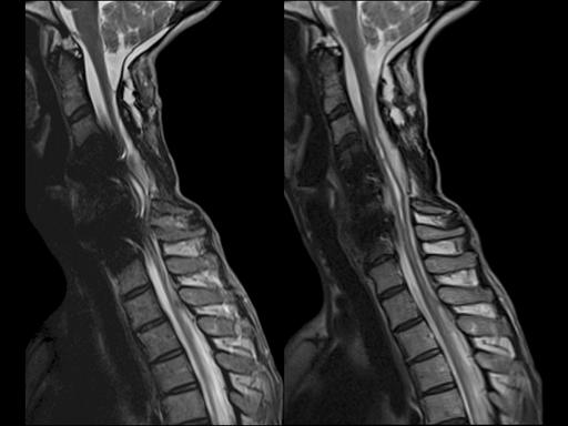MAGNETOM Verio Upgrade Siemens Healthineers Italia