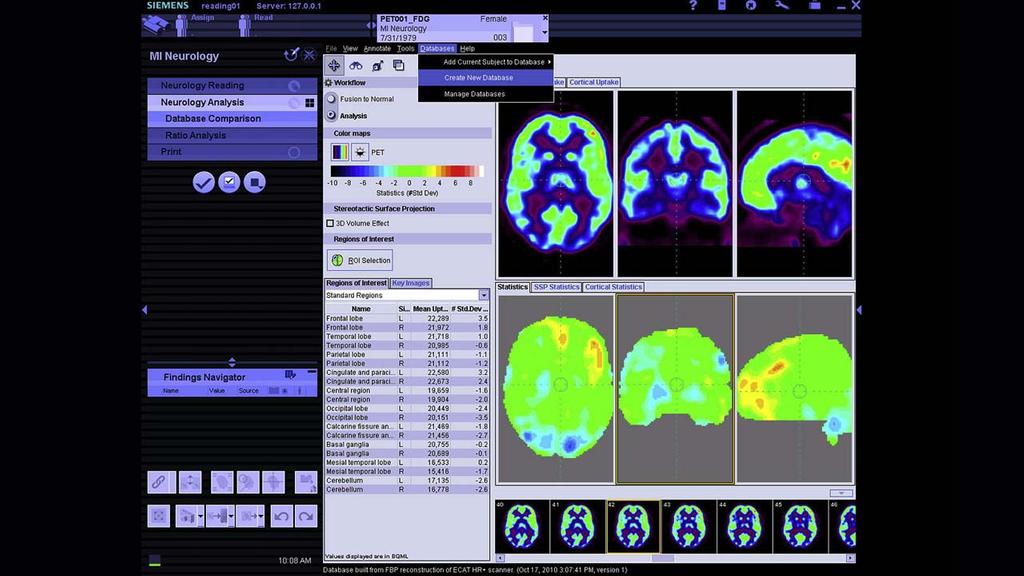 syngo.via Siemens Healthineers Italia