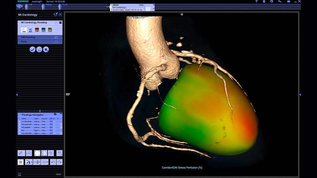 syngo.via Siemens Healthineers Italia
