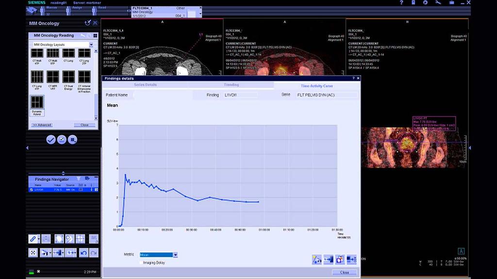 syngo.via Siemens Healthineers Italia