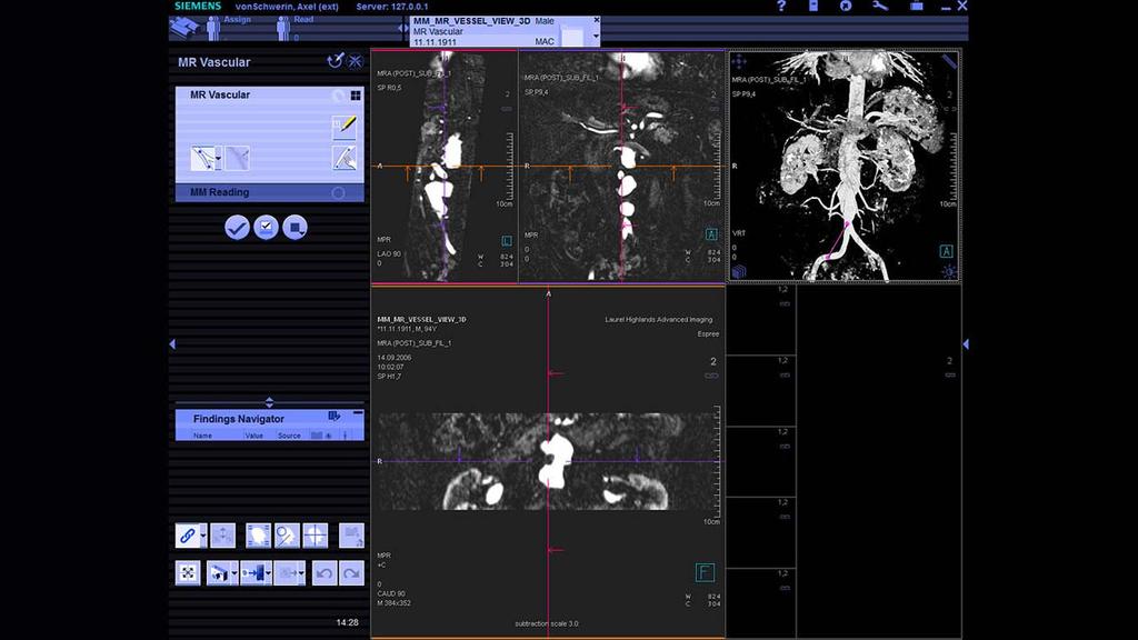 syngo.via Siemens Healthineers Italia