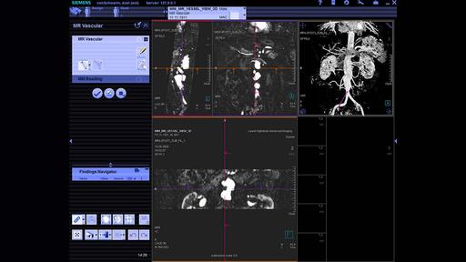 syngo.via Siemens Healthineers Italia