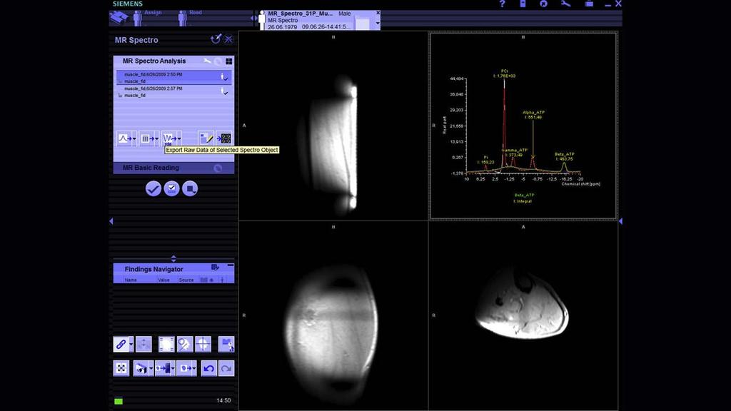 syngo.via Siemens Healthineers Italia