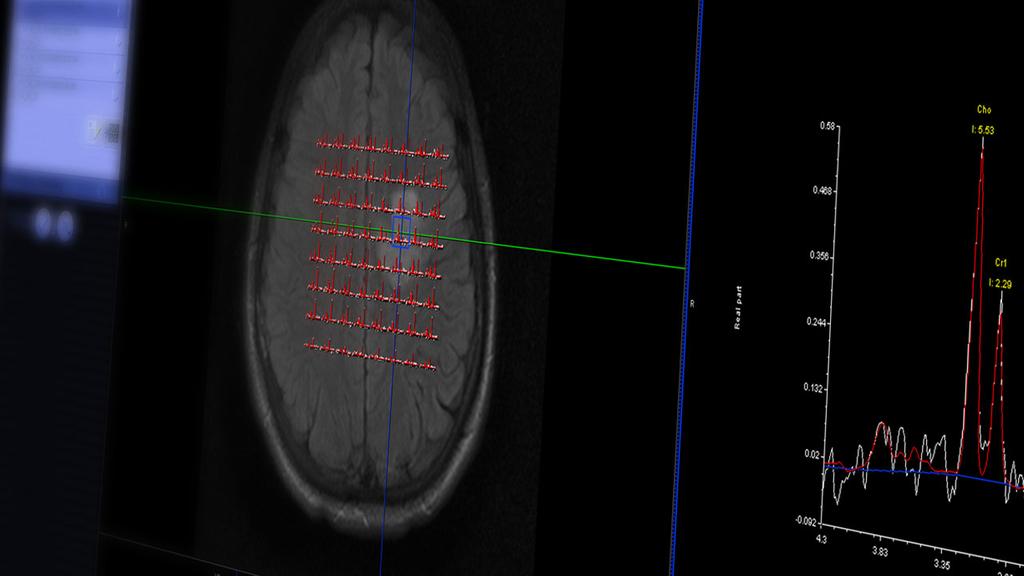 syngo.via for Interventional Imaging - Siemens Healthineers USA