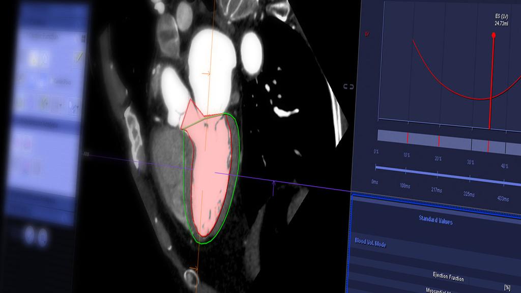 syngo.via for Interventional Imaging - Siemens Healthineers USA