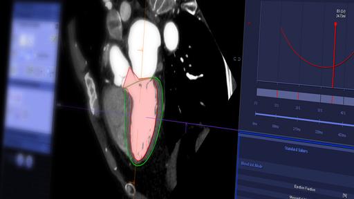 syngo.via for Interventional Imaging - Siemens Healthineers USA