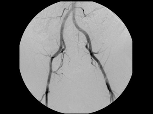 Refurbished Fluoroscopy System - AXIOM Luminos TF eco Siemens ...