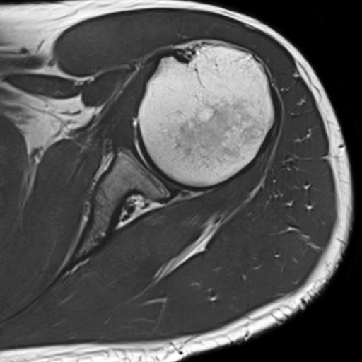 Shoulder Large 16, Shoulder Small 16 - Siemens Healthineers USA