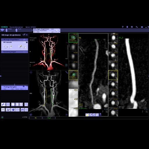 syngo.MR Vascular Analysis - Siemens Healthineers USA