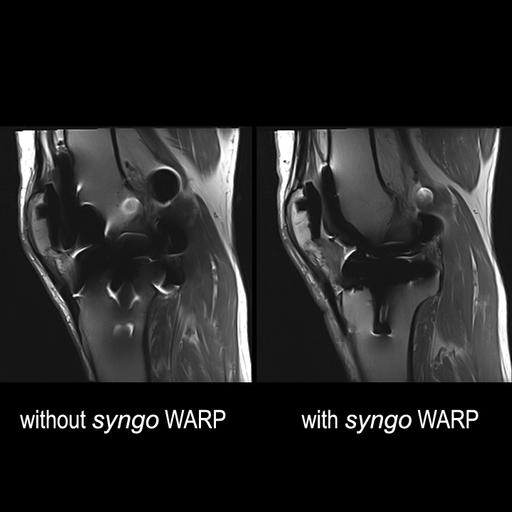 syngo WARP - Siemens Healthineers USA