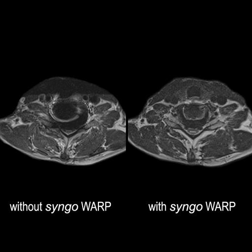 syngo WARP - Siemens Healthineers USA