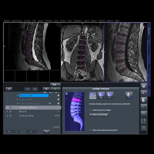 Spine Dot Engine - Siemens Healthineers USA